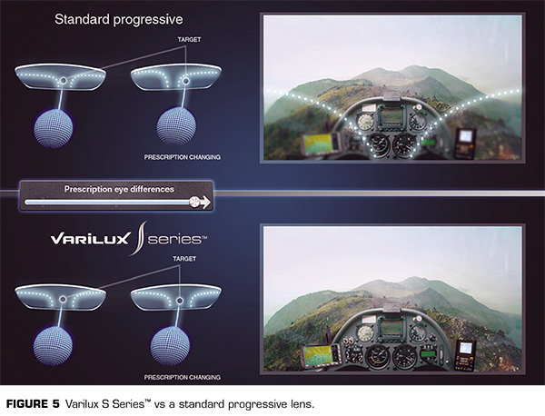 The Varilux S Series™: 4D Technology™ | VisionPlus Magazine