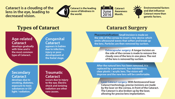 Keeping An Eye On Cataract | VisionPlus Magazine