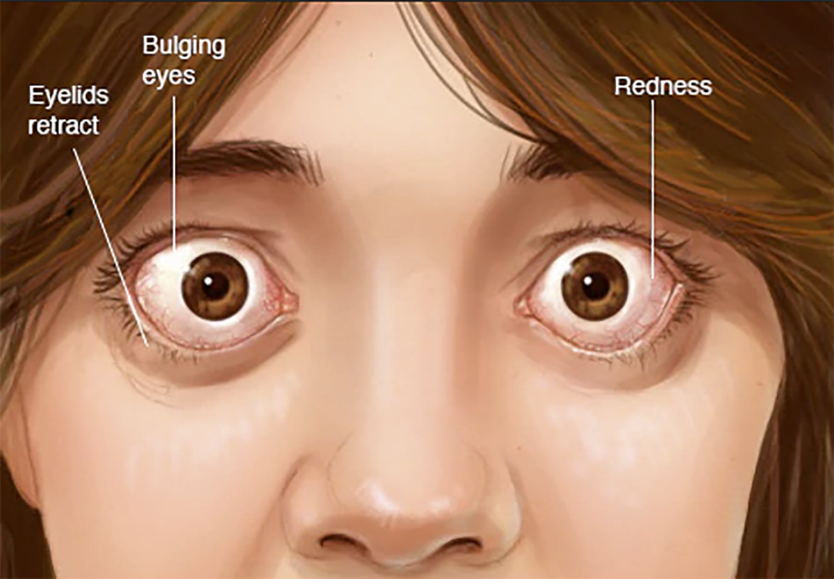 What Your Eye Symptoms May Mean | VisionPlus Magazine